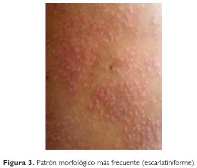 Exantema; Erupción; Rash Cutáneo