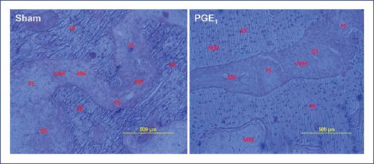 Histomorphometry evaluation of bone anabolism promoted by prostaglandin ...