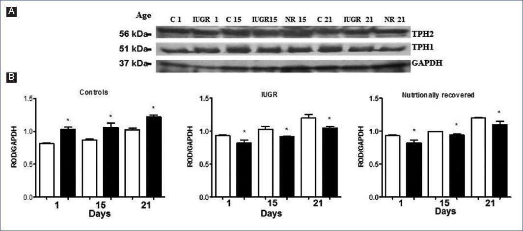 How intrauterine growth restriction due to nutritional stress changes ...