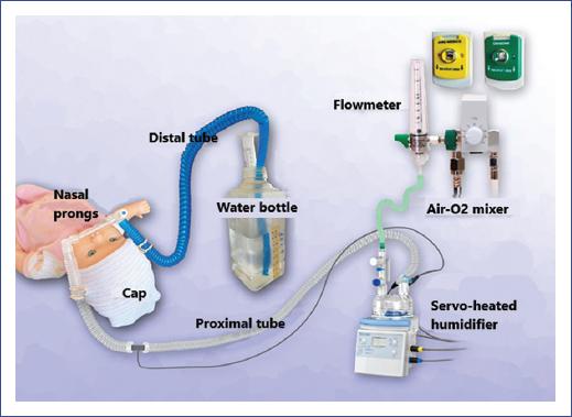 Perception of neonatology staff regarding the availability of equipment ...