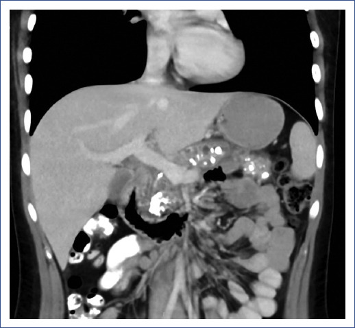 Clinical and paraclinical characteristics in pediatric patients with ...