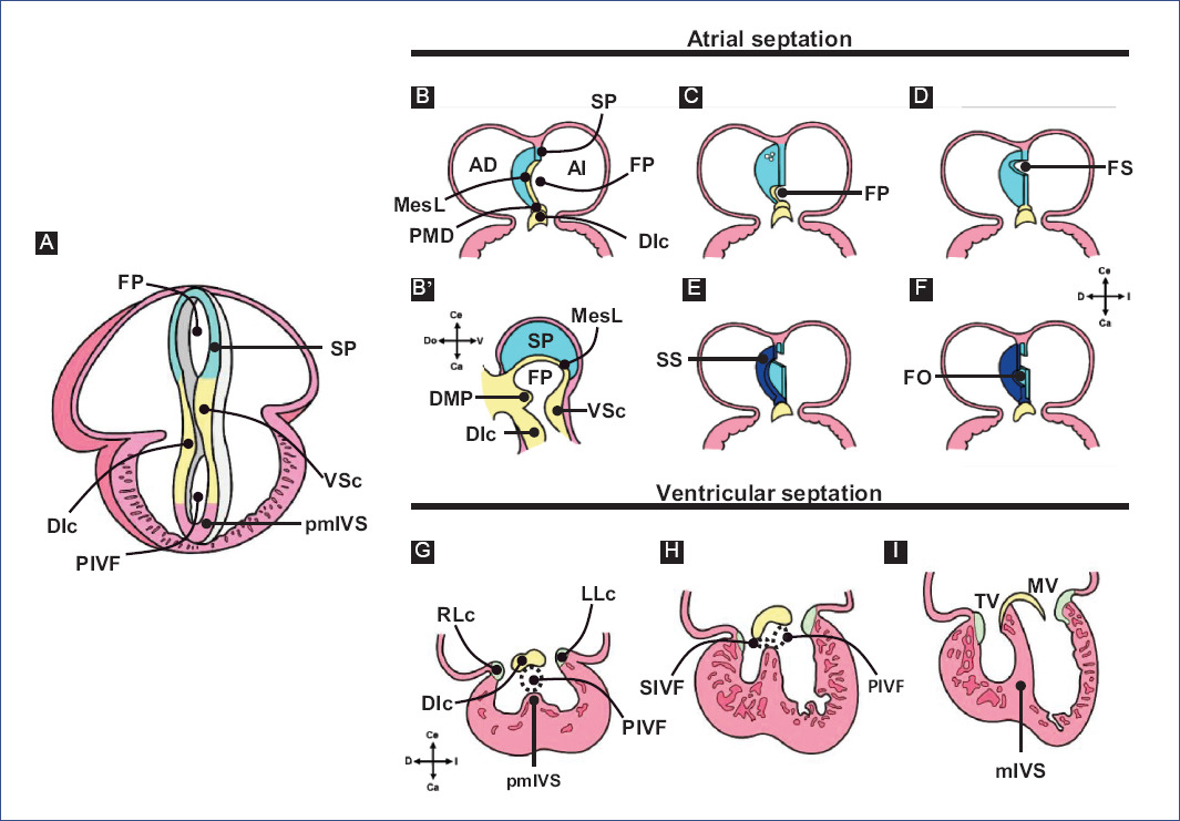 Development Of Interventricular Septum Flowchart