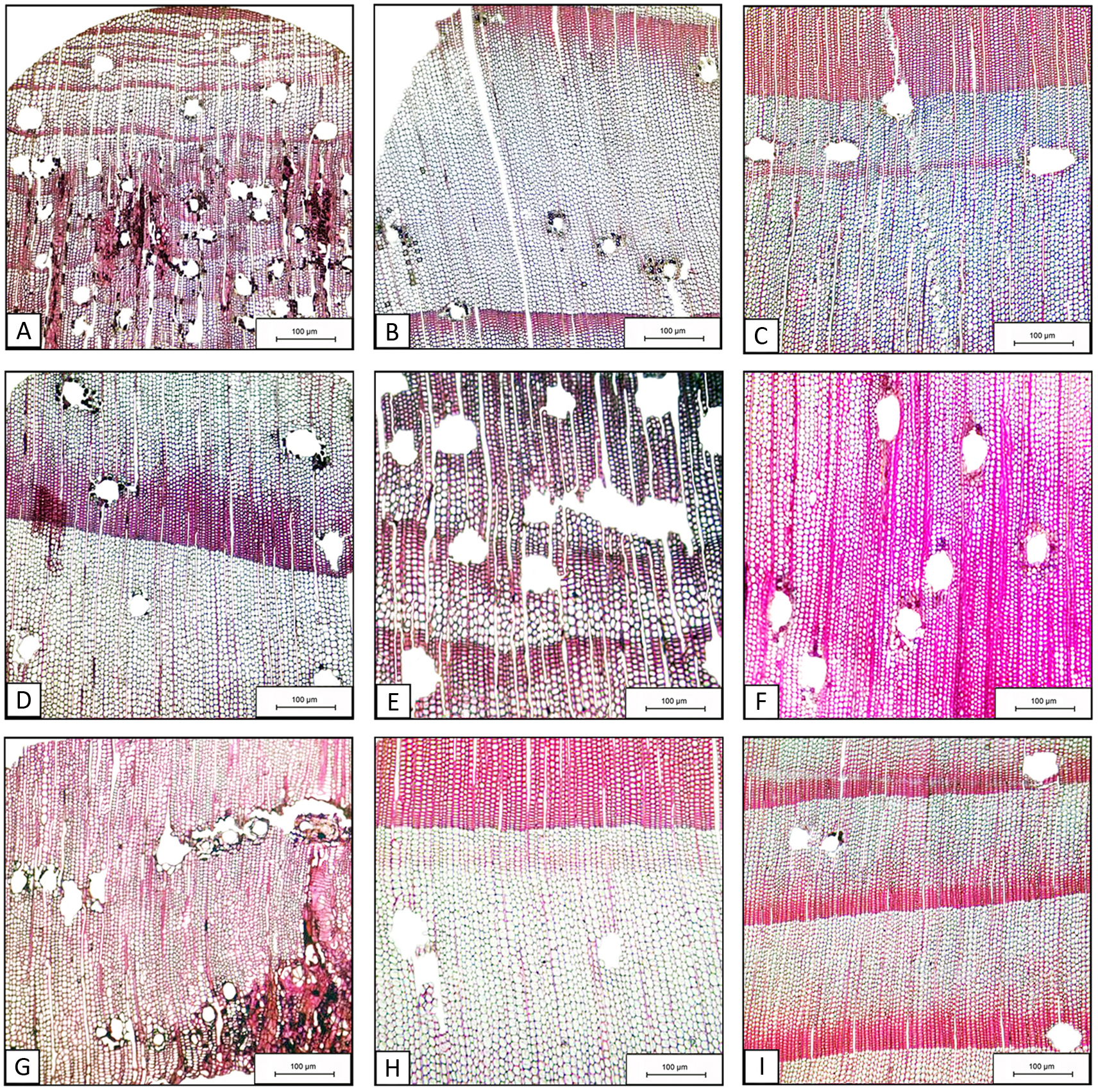 Dendrometric variables and traumatic resin ducts in pine species ...