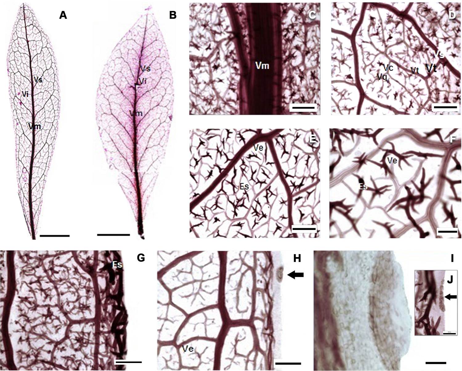 Anatomy and foliar architecture of two Mexican species of Ternstroemia ...