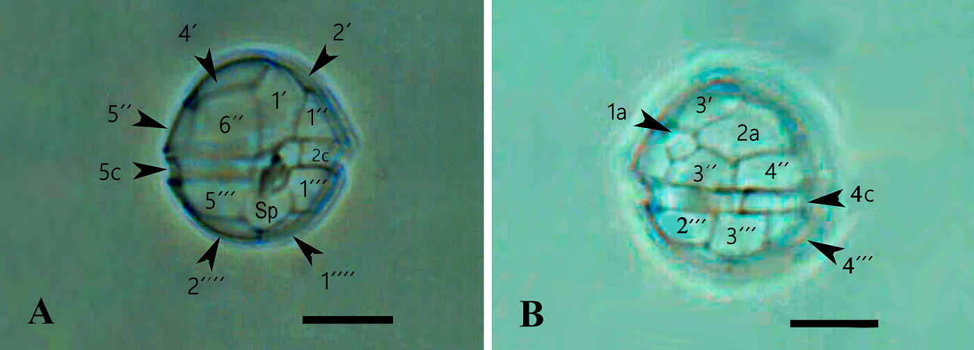 Timescale lessons of Durinskia baltica (Kryptoperidiniaceae, Dinophyta ...