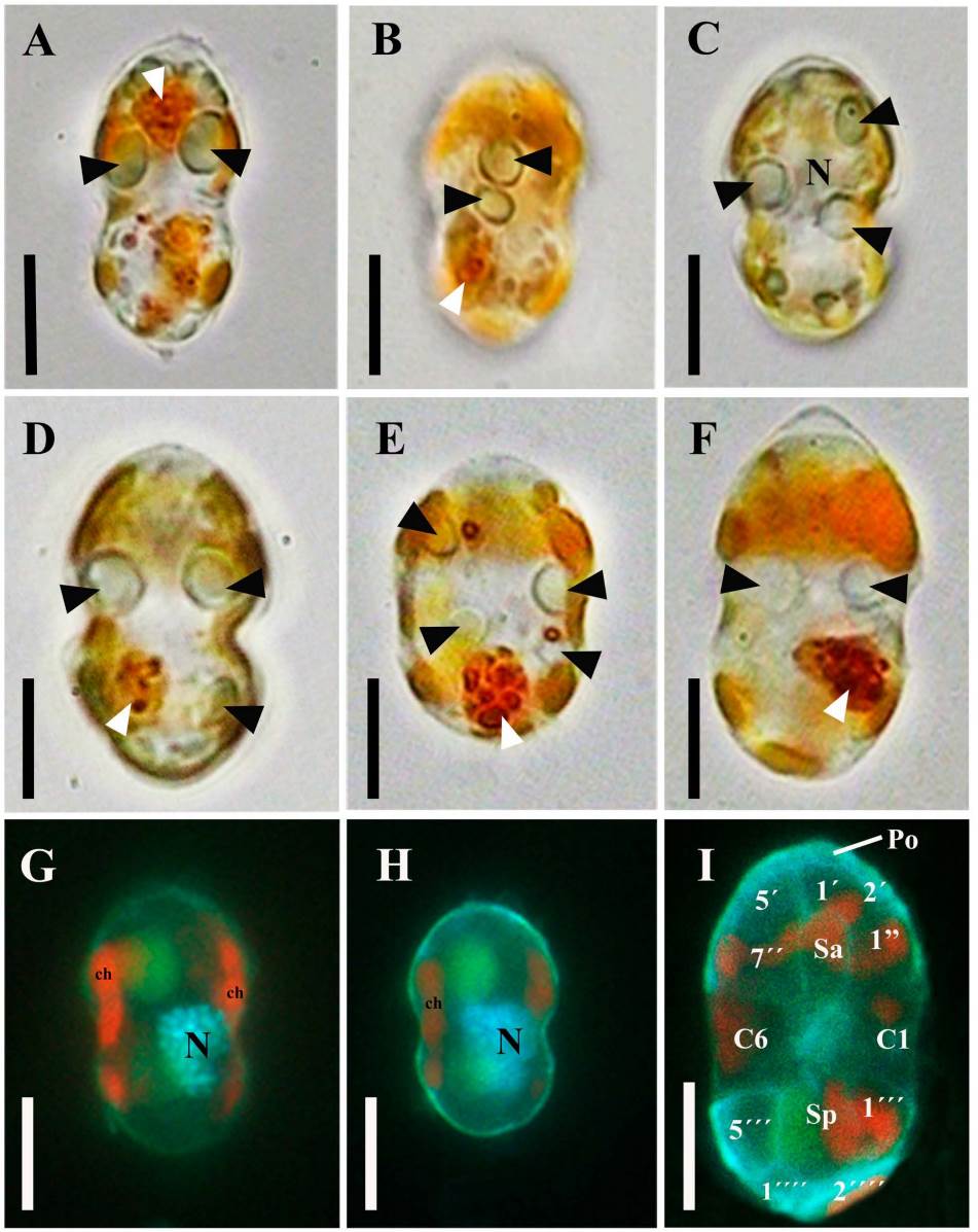 Species of the thecate dinoflagellate genus Heterocapsa (Dinophyceae ...