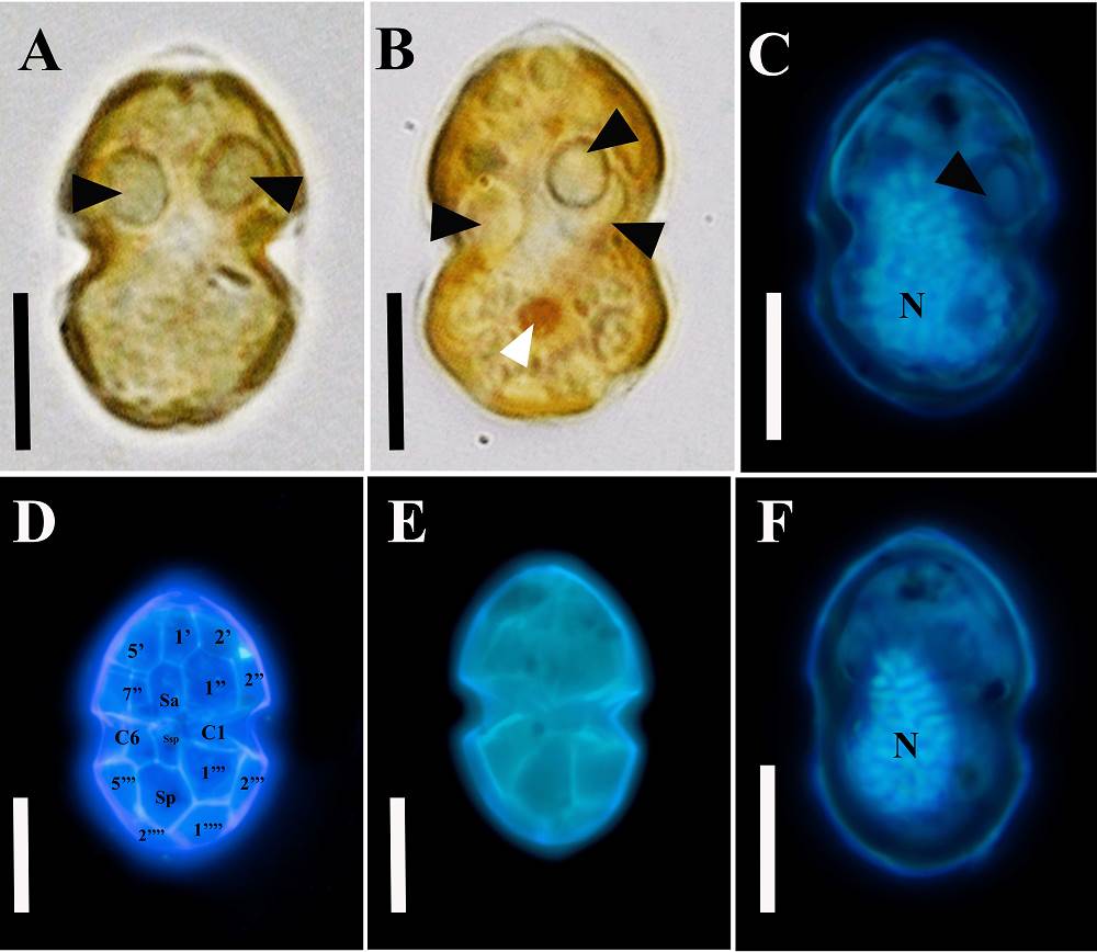 Species of the thecate dinoflagellate genus Heterocapsa (Dinophyceae ...