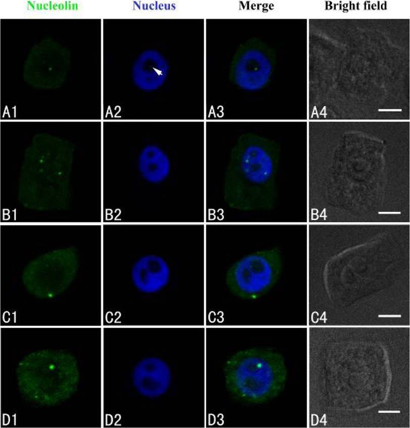 Effects of cadmium on nucleolus in root tips of Hordeum vulgare