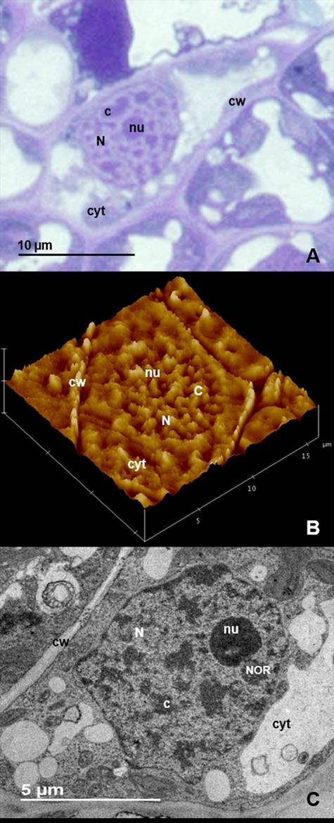 Lacandonia granules are present in the cell nucleus of Welwitschia ...