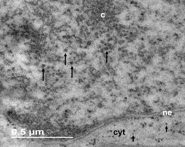 Lacandonia granules are present in the cell nucleus of Welwitschia ...