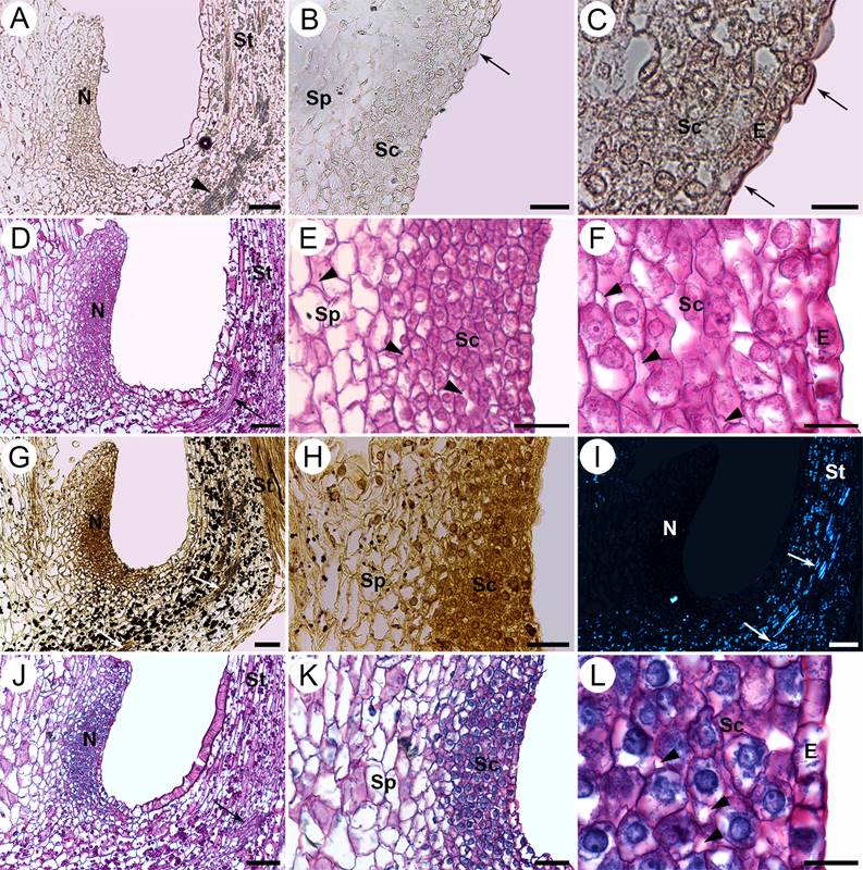 The structure of nectaries in the genus Strombocactus (Cactaceae)