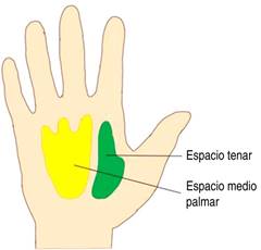 Síndrome compartimental en extremidades