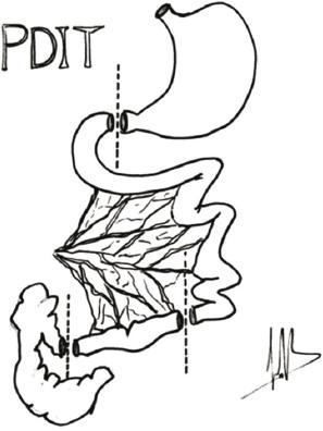 A novel surgical technique focused on the study of the ileum: The ...
