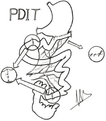 A novel surgical technique focused on the study of the ileum: The ...