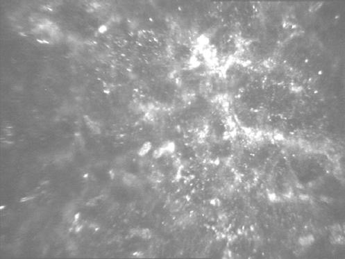 Hallazgos in vivo mediante microscopía confocal en cirugía refractiva SMILE