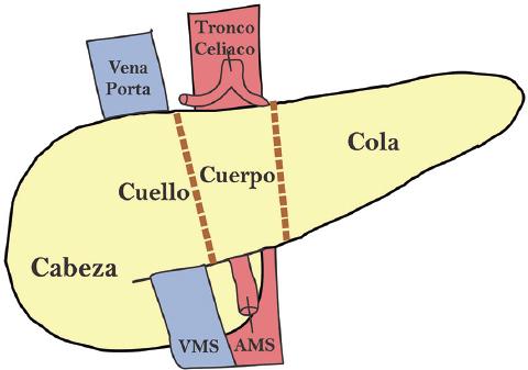 Pancreatectomía distal: experiencia en un hospital de referencia nacional