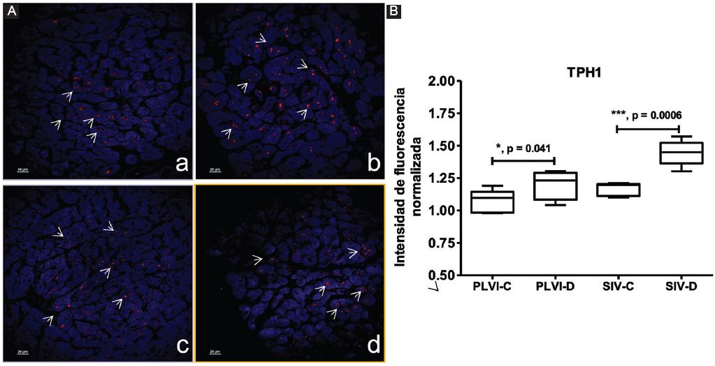 Triptófano-5-hidroxilasa, transportador de serotonina y receptores ...