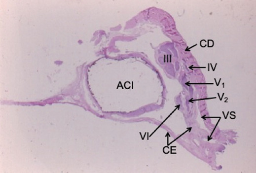 Seno cavernoso: anatomía, histología y terminología