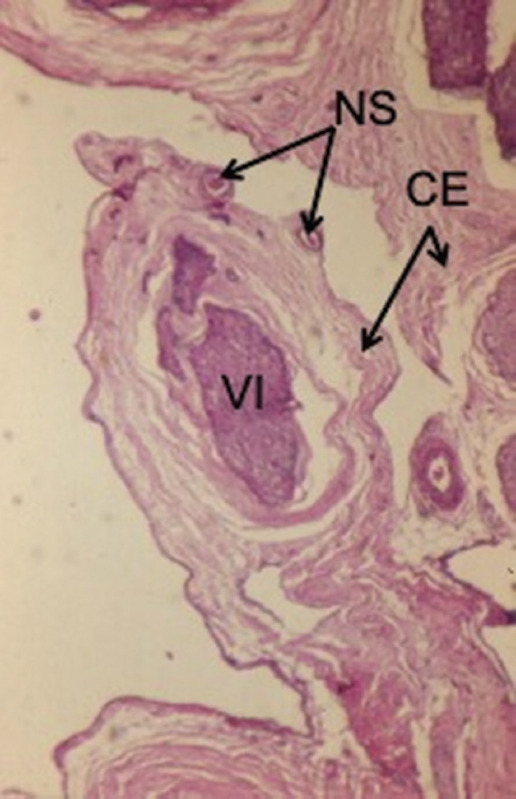 Seno cavernoso: anatomía, histología y terminología
