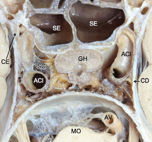 Seno cavernoso: anatomía, histología y terminología