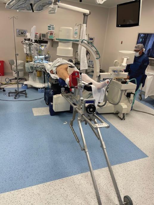 Comparison of early complications for primary total hip arthroplasty ...