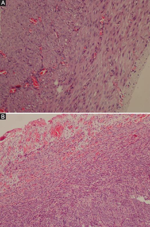 The effect of platelet-rich plasma on intra-abdominal adhesions in ...