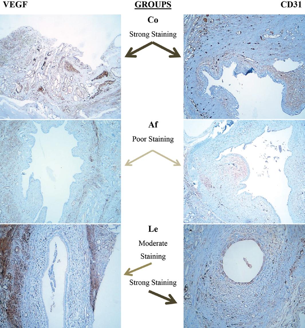 The effect of antiangiogenic agent aflibercept on surgically induced ...