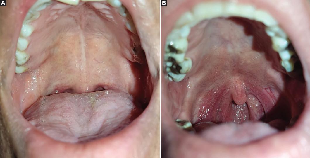 Detección clínica y descripción de las características ...