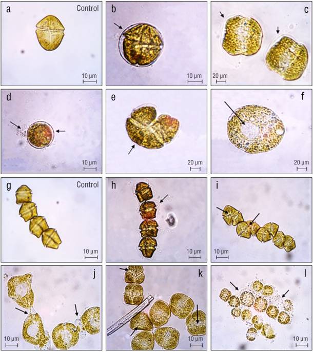 Effect of a bacterial consortium on the growth, morphology, pigments ...