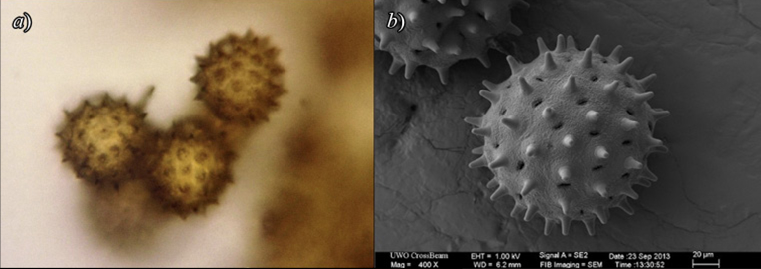 El microscopio bajo mis manos: breve historia, funcionamiento y ...