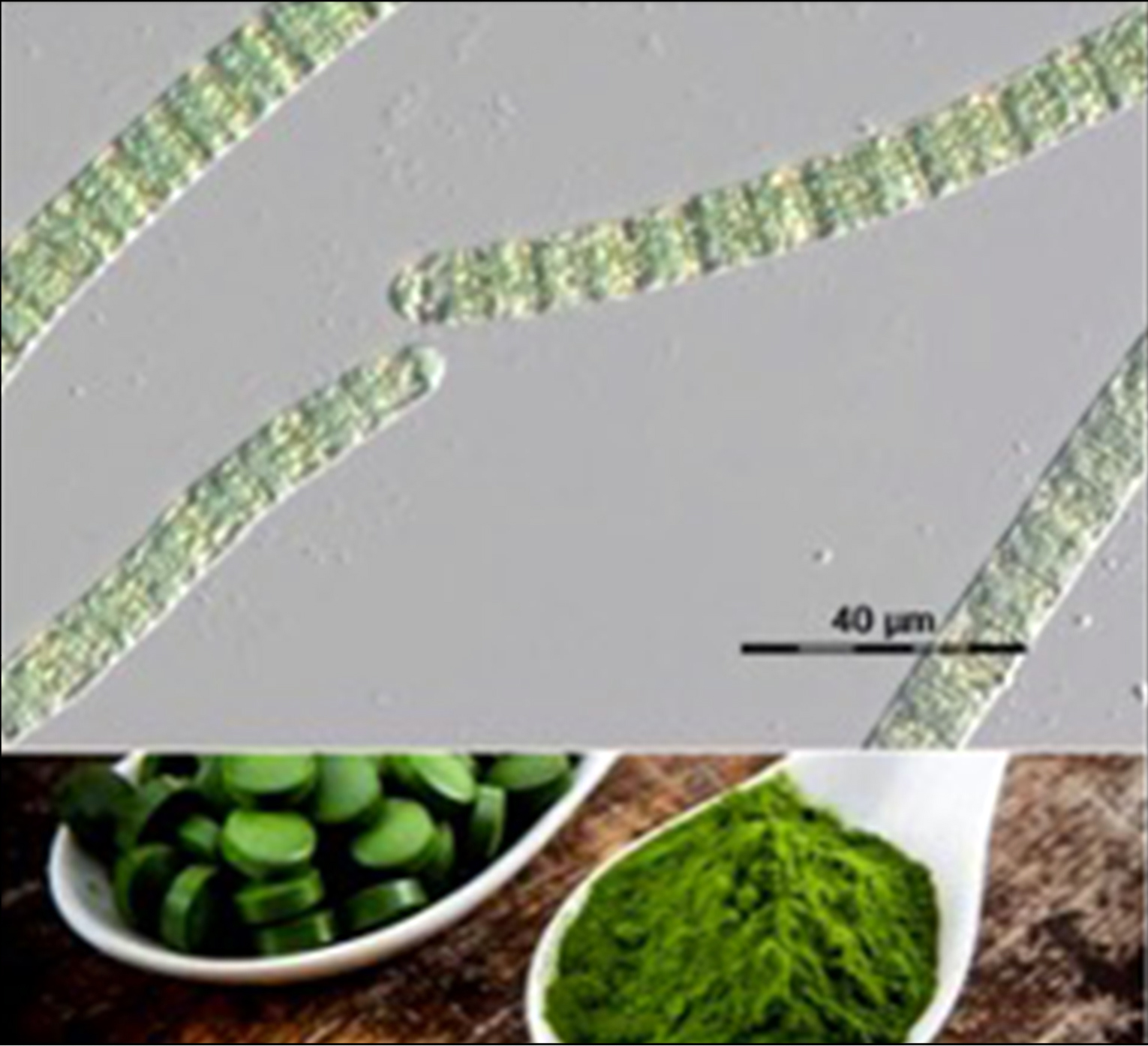 Producción masiva de microorganismos para la obtención de proteína ...