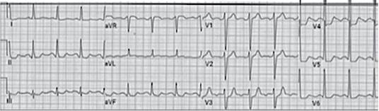 The U wave: an ignored wave filled with information