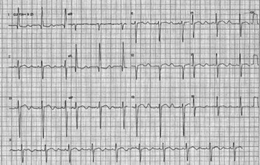 The U wave: an ignored wave filled with information