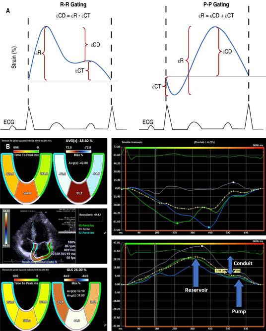 Triplane left atrial strain