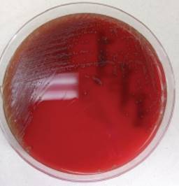 An unexpected germ: atypical presentation of Vagococcus fluvialis ...