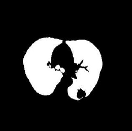 Automated Lung Segmentation on Computed Tomography Image for the ...