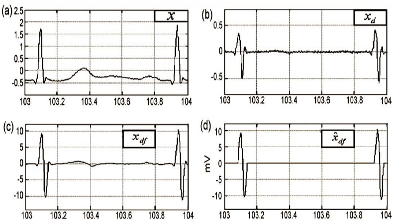 Cardiac Abnormalities Detection from Compressed ECG
