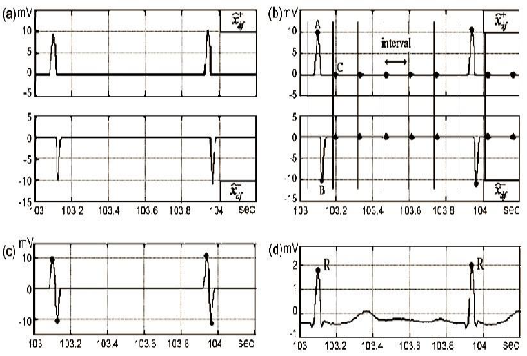 Cardiac Abnormalities Detection from Compressed ECG