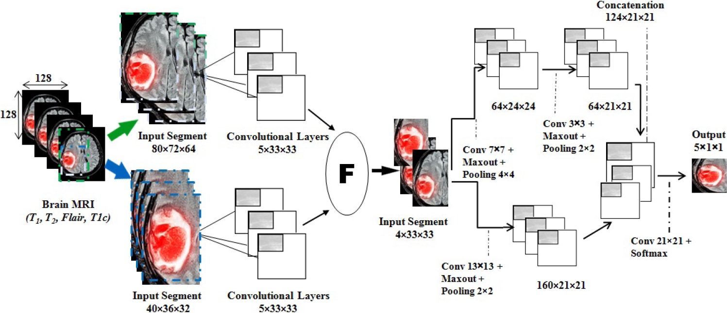 A System for Brain Image Segmentation and Classification Based on Three ...