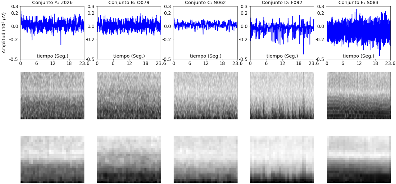 Detección de señales EEG epilépticas utilizando redes convolucionales ...