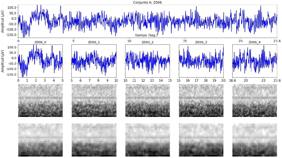 Detección de señales EEG epilépticas utilizando redes convolucionales ...