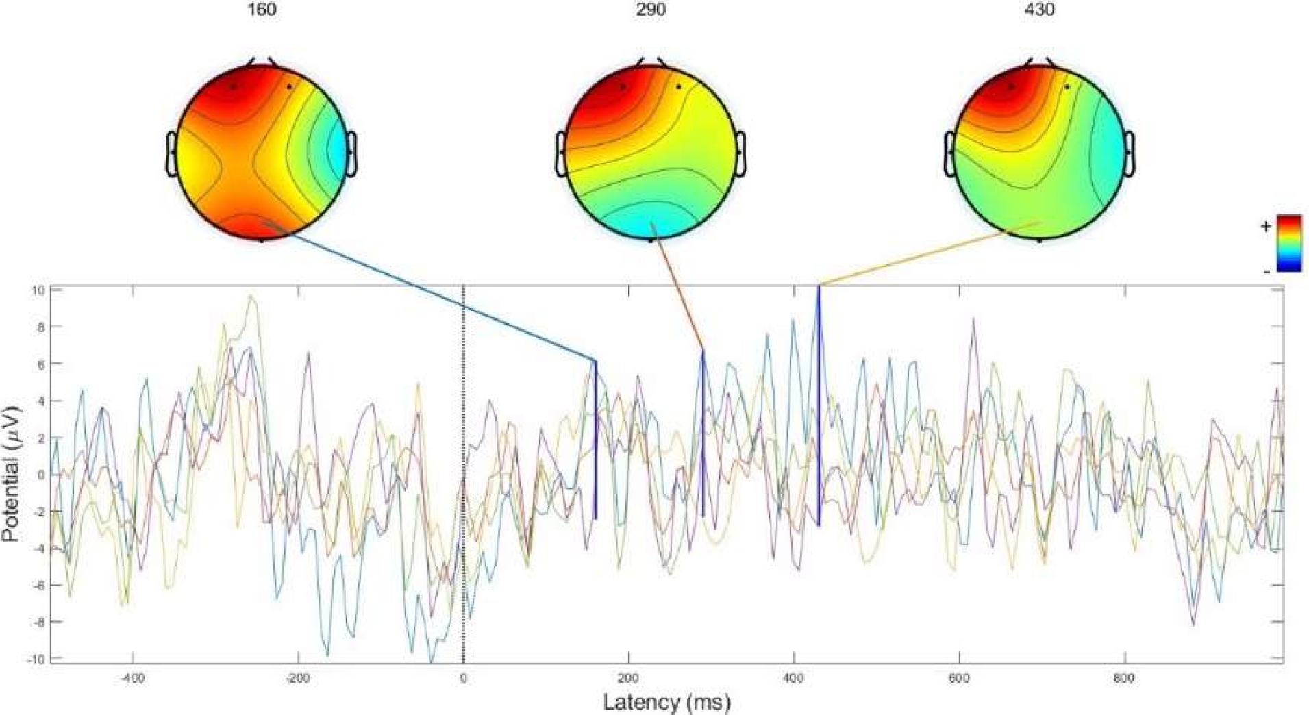Estimulación visual basada en conceptos y su análisis mediante ...