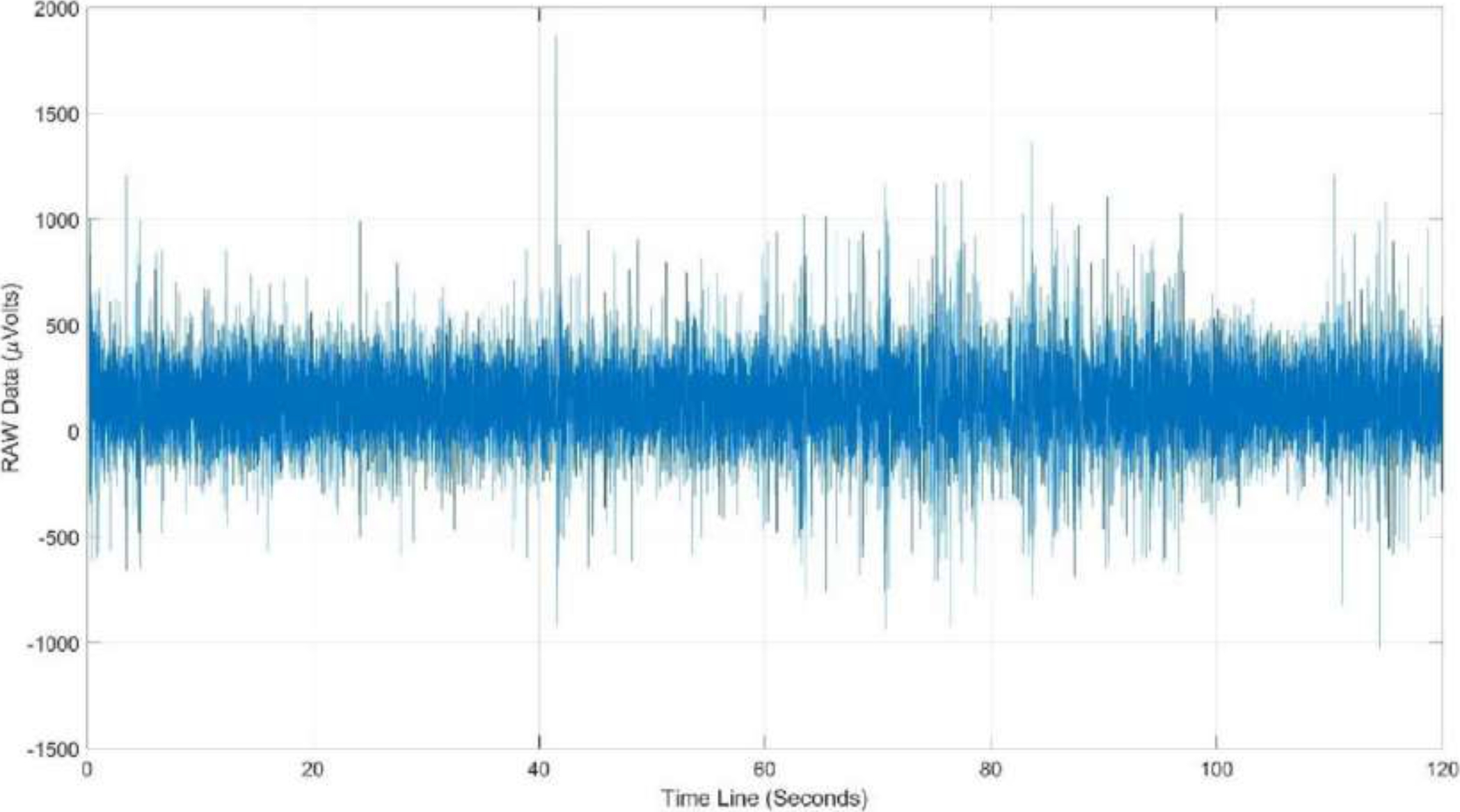 Power Spectral Analysis of Bioacoustic Signals Emitted by a Bottlenose ...