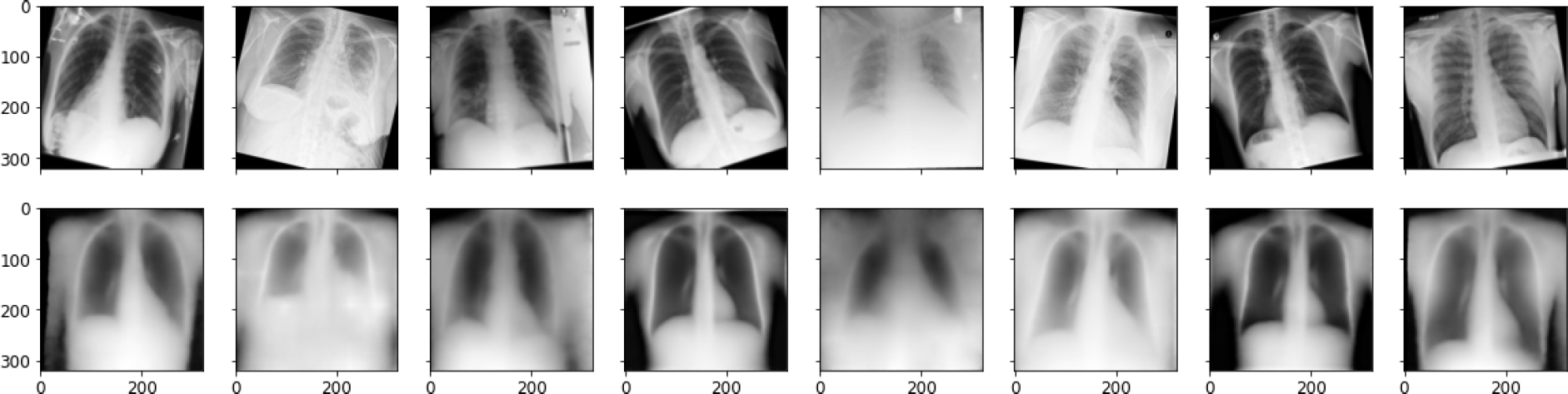 PumaMedNet-CXR: An Explainable Generative Artificial Intelligence for ...