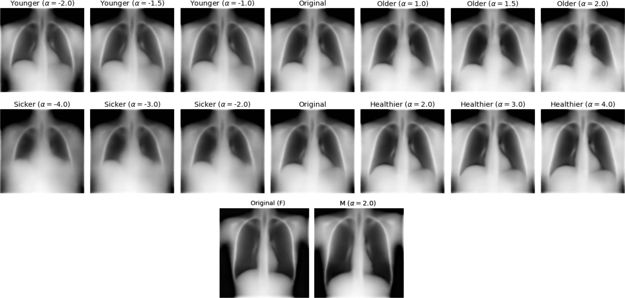 PumaMedNet-CXR: An Explainable Generative Artificial Intelligence for ...