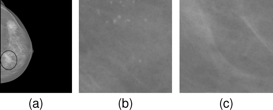 Lightweight CNN for Detecting Microcalcifications Clusters in Digital ...