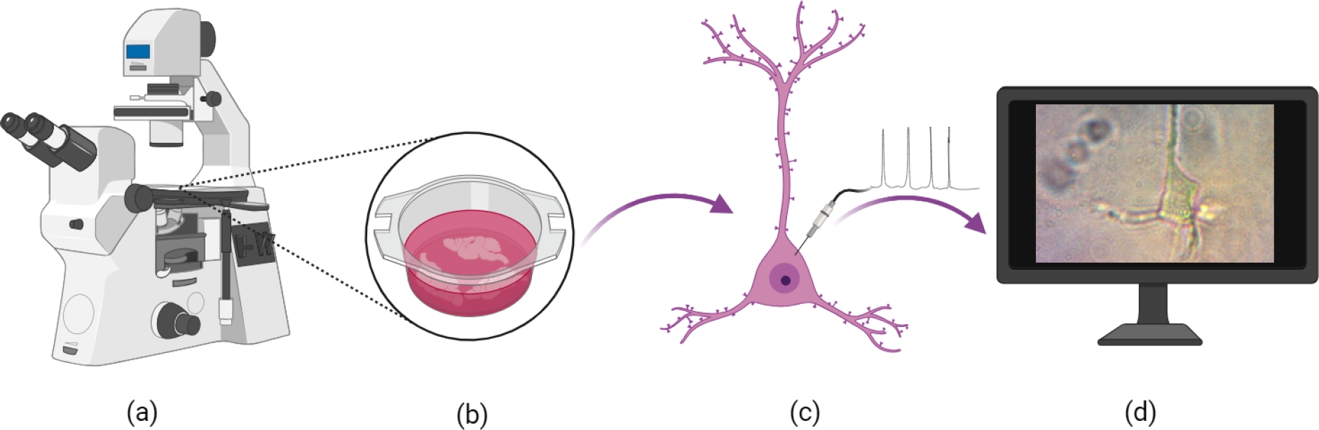 Pyramidal Rat Neurons Segmentation in Microscopy Low-Resolution Images