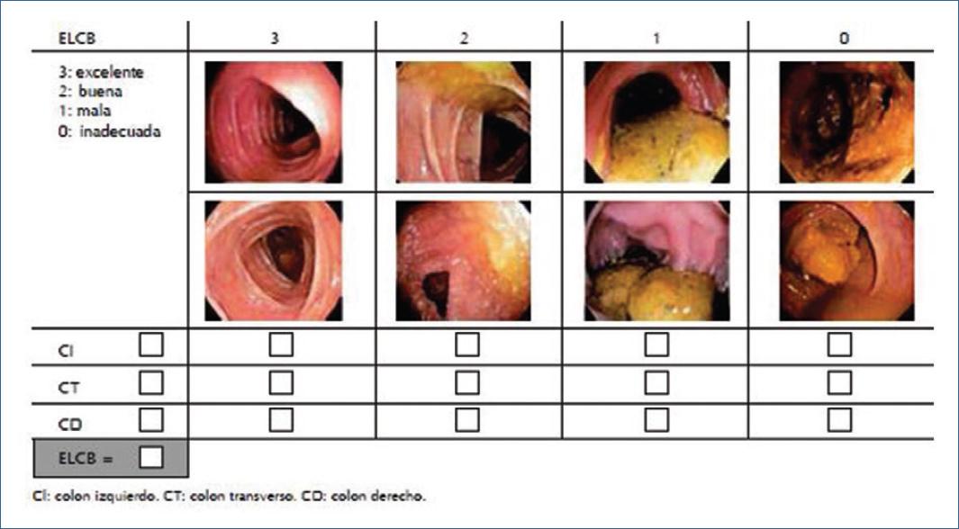 Factores de riesgo para la preparación intestinal inadecuada en ...