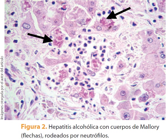 El centenario de la descripción de los cuerpos de Mallory