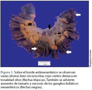 Fiebre entérica en fase de fastigium: notas epicríticas acerca de un ...
